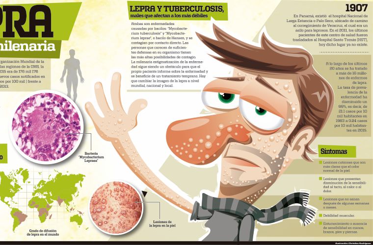 Lepra, enfermedad milenaria | Día a Día